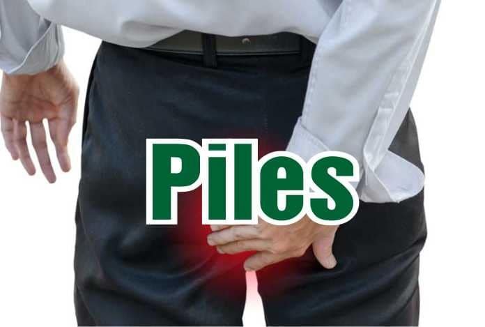 Home remedies for Piles | पाइल्स के ये हैं घरेलू उपाए